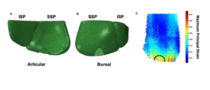 Finite element-based evaluation of the supraspinatus tendon ...