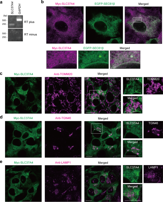 SLC37A4, gene responsible for glycogen storage disease type 1b ...
