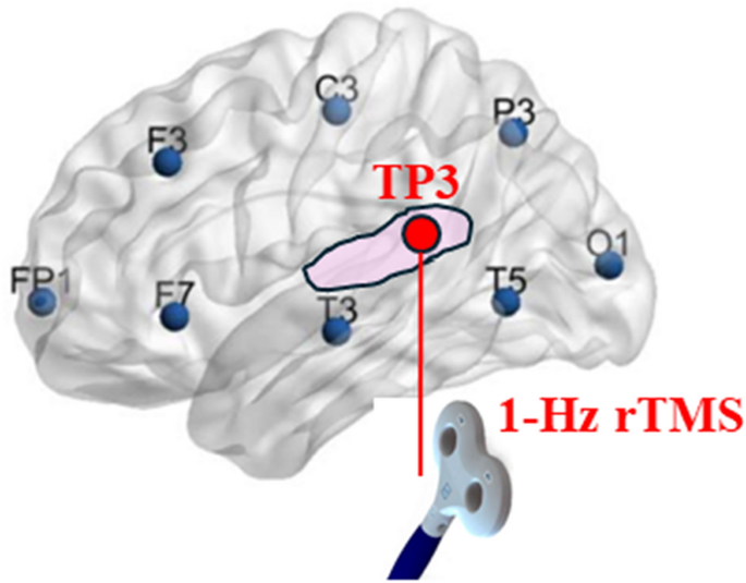 Investigating the effect of rTMS over the temporoparietal cortex on the ...