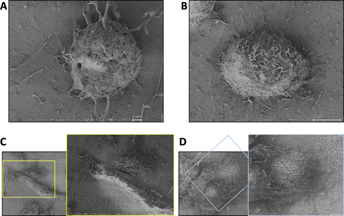 Histamine stimulates human microglia to alter cellular prion protein ...