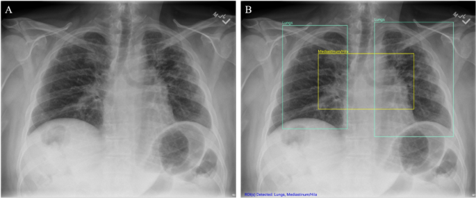 Deep learning improves physician accuracy in the comprehensive detection of abnormalities on ...