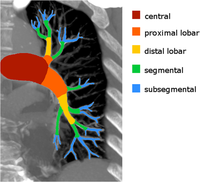 Lipoprotein (a) is not associated with thrombus burden derived from CT ...