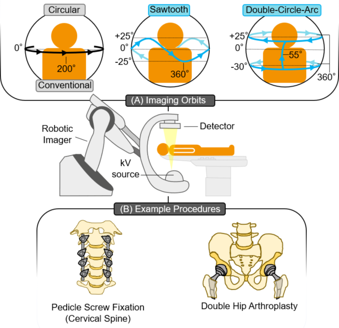 Universal non-circular cone beam CT orbits for metal artifact reduction ...