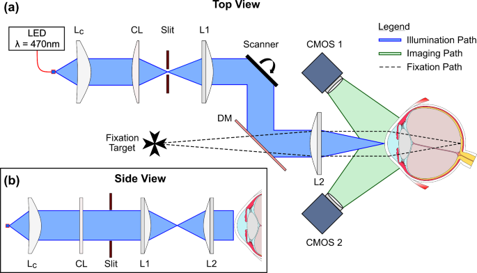 Stereo slit-scanning tomography of the anterior segment of the human ...