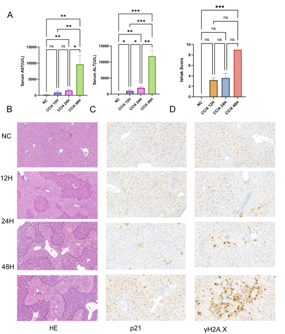 Identification of stable housekeeping genes in mouse liver for studying ...