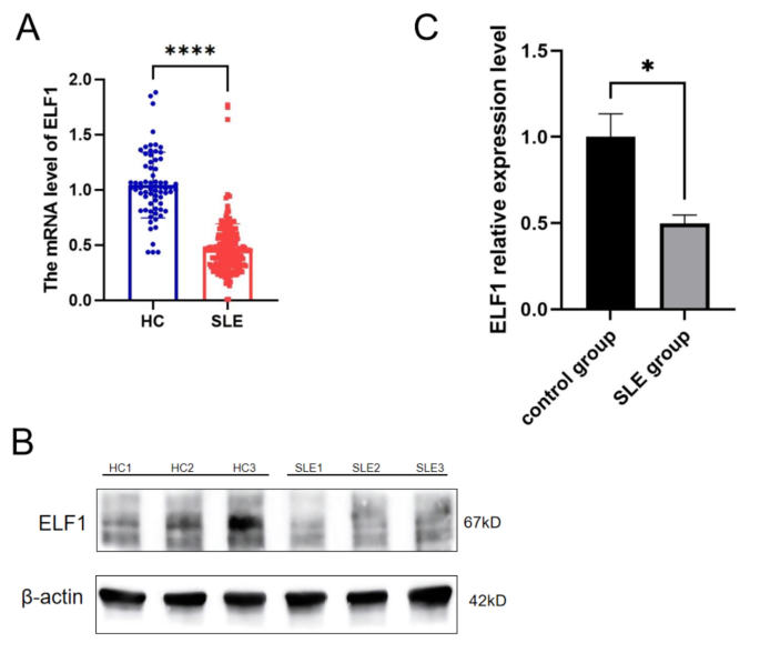ELF1 serves as a potential biomarker for the disease activity and renal ...