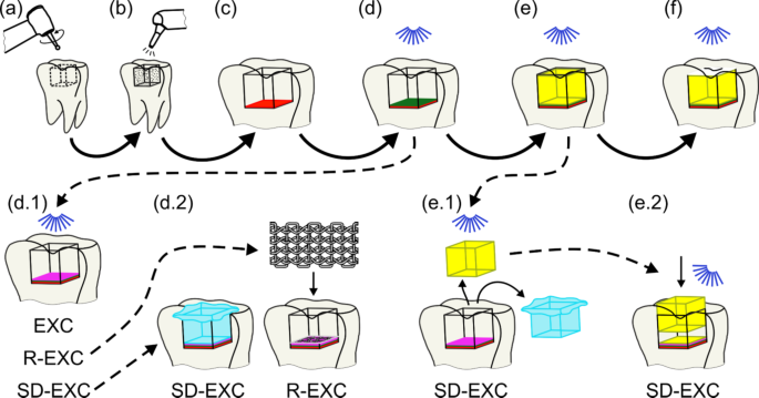 The effect of various bulk filling techniques on the mechanical and ...