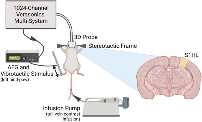 Non-invasive 4D transcranial functional ultrasound and ultrasound ...