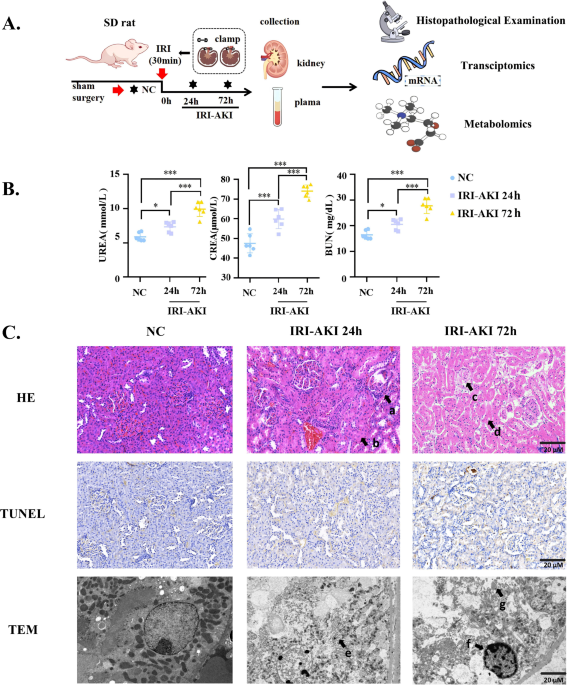 Metabolomic and transcriptomic insights into the mechanisms of renal ischemia-reperfusion injury ...