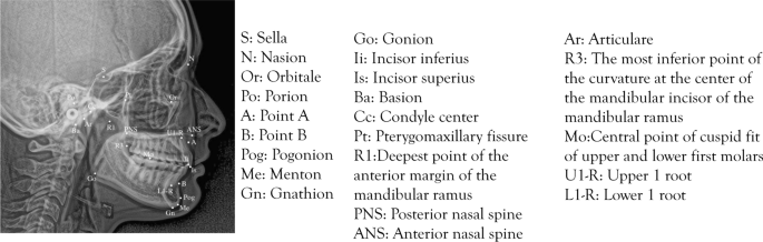Accuracy of cephalometric landmark and cephalometric analysis from ...