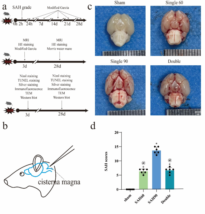 Progressive histological and behavioral deterioration of a novel mouse ...