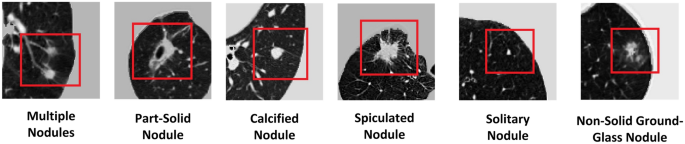 A lung nodule segmentation model based on the transformer with multiple ...