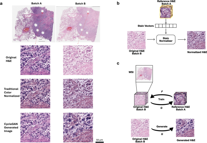 Impact of stain variation and color normalization for prognostic ...