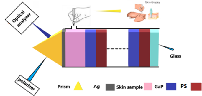 Vitiligo detection capabilities of 1D photonic crystal biosensing design | Scientific Reports