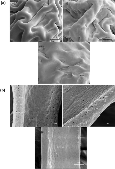 Immobilization of enzymes for synergy in polymers to produce lactose ...