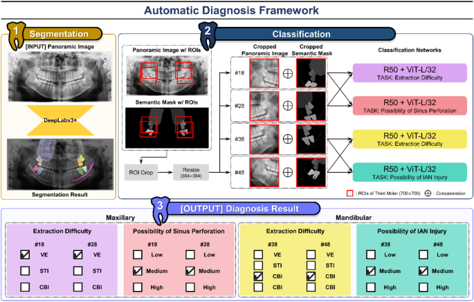 Automated diagnosis for extraction difficulty of maxillary and mandibular third molars and post ...