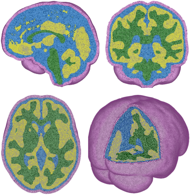 Brain modes of resonance estimated by a biophysical multi-compartment ...