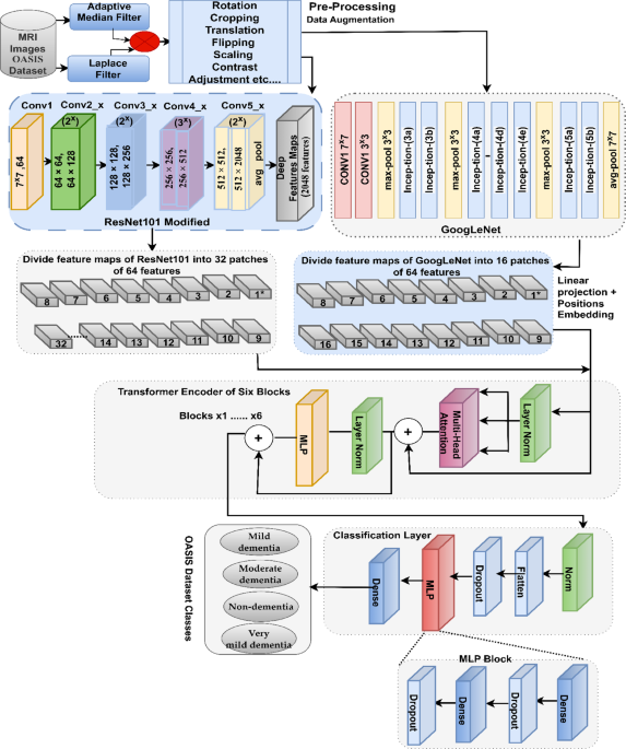 Early detection of Alzheimer’s disease progression stages using hybrid ...