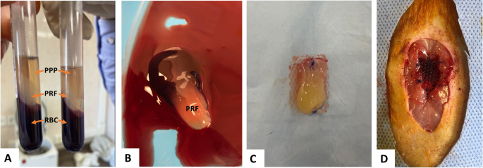 Platelet-rich fibrin decreases adhesion to polypropylene prosthetic ...