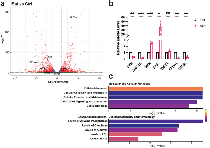Creatine mitigates neurogenesis impairment caused by defective DcpS ...