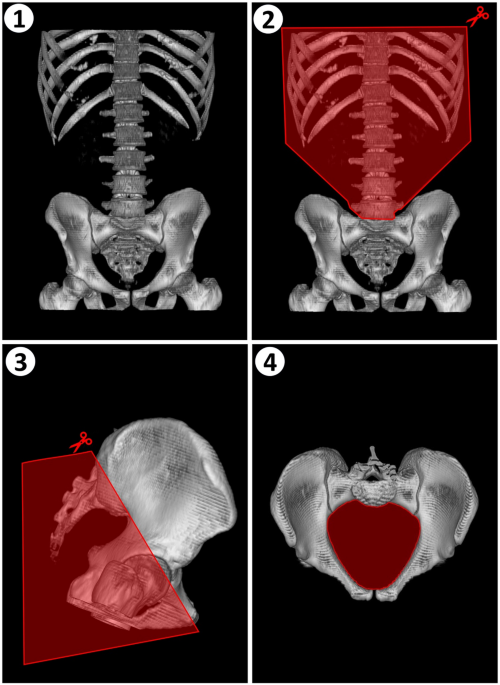Sex determination using image processing reveals elliptical features of ...