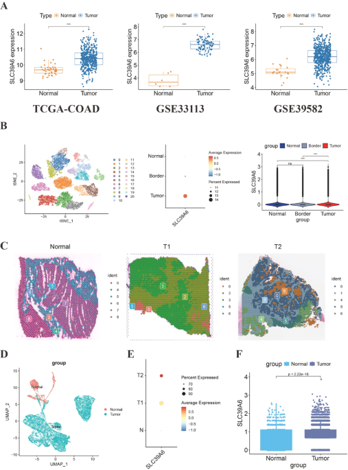 Investigation of the cytotoxic effects and mechanisms of the SLC39A6 ...