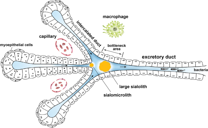 Protein expression of sialolith with antrolith and tonsillolith ...