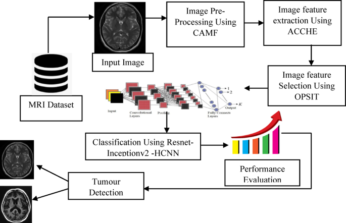 Enhanced image registration based brain tumour segmentation using optical particle swarm ...