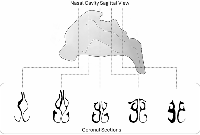 Creating nasal cycle simulations by processing MRI and CT scan data ...