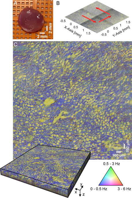 Label-free volumetric imaging of porcine kidney tissue over extended ...
