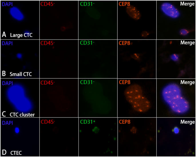 Small cell size circulating tumor cells predict the prognosis of high ...