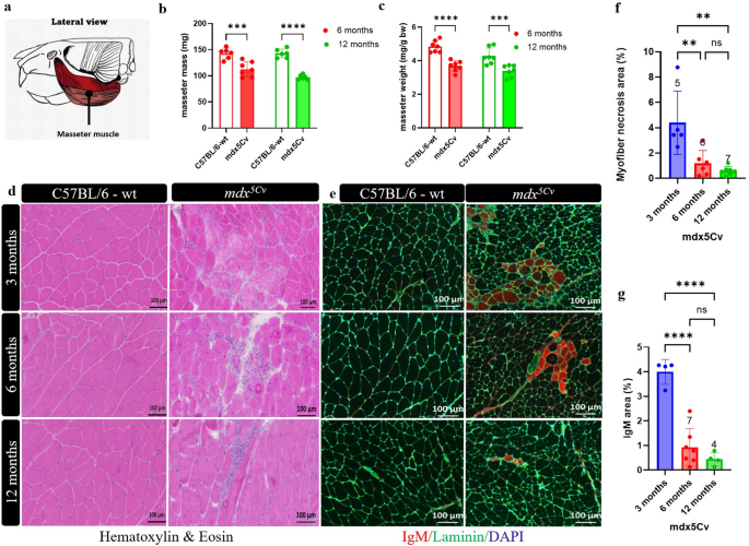 Persistent tissue regeneration and transforming growth factor-β induced ...