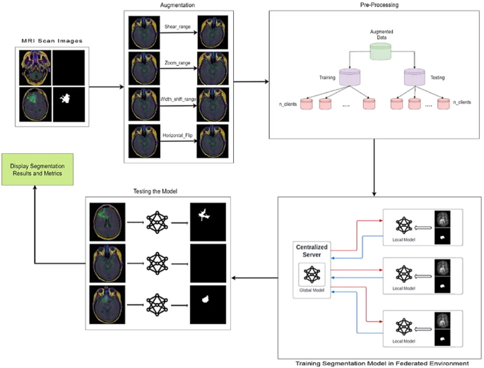 Enhanced brain tumour segmentation using a hybrid dual encoder–decoder model in federated ...
