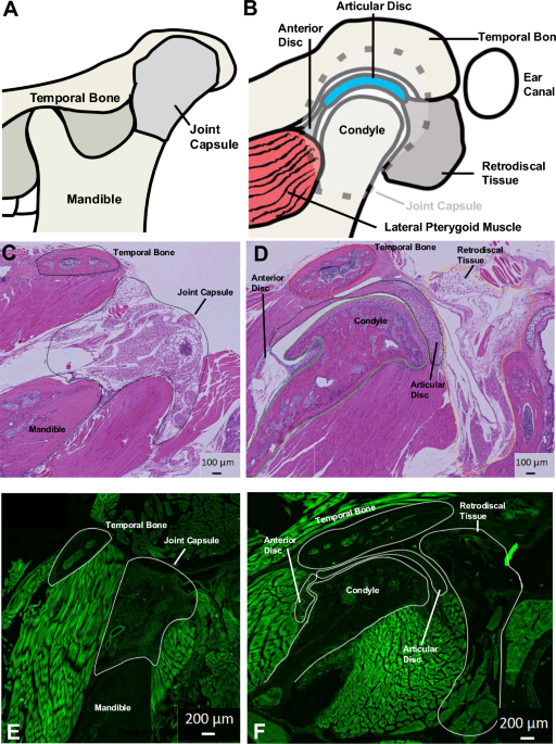 Identification of sensory fiber types in mouse temporomandibular joint ...