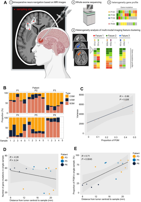 An optimized tissue sampling scheme guided by MRI features reveals intratumoral heterogeneity in ...