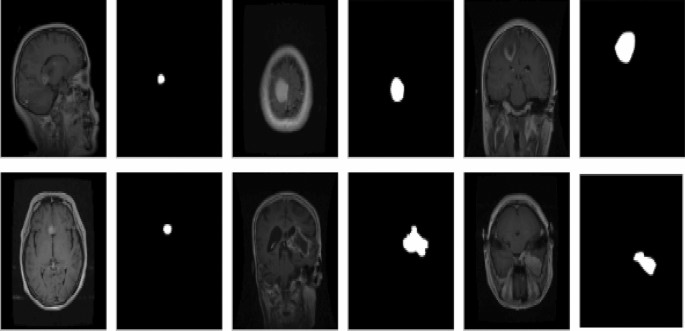 A lightweight network for brain MRI segmentation | Scientific Reports
