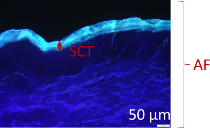 A pilot study on the cutaneous effects of ethanol in a moisturizing ...