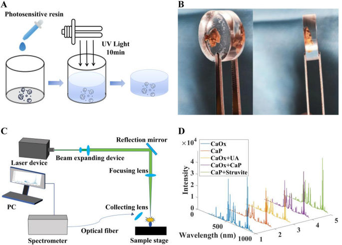 Elemental composition analysis of calcium-based urinary stones via ...
