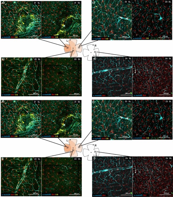 Correction: Local microglial activation induced and labeled in the ...
