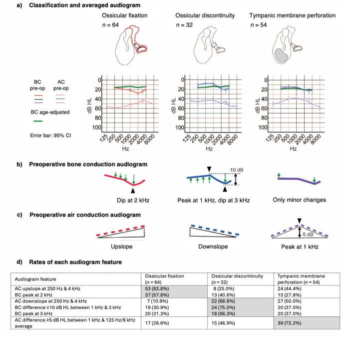 The bone conduction threshold pattern may help to estimate the ...