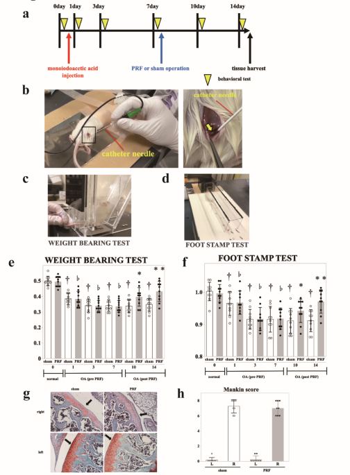 Elucidation of the treatment mechanism of pulsed radiofrequency based ...