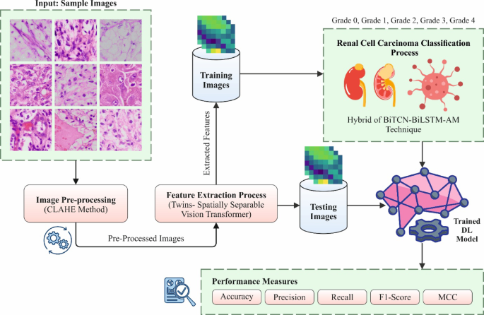 Advanced transformer with attention-based neural network framework for ...