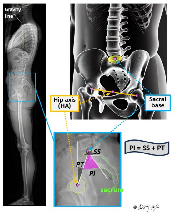 Normality of sagittal spinal alignment parameters reveals evolutionary ...
