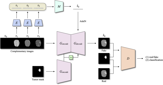 Laplacian filter attention with style transfer GAN for brain tumor MRI ...