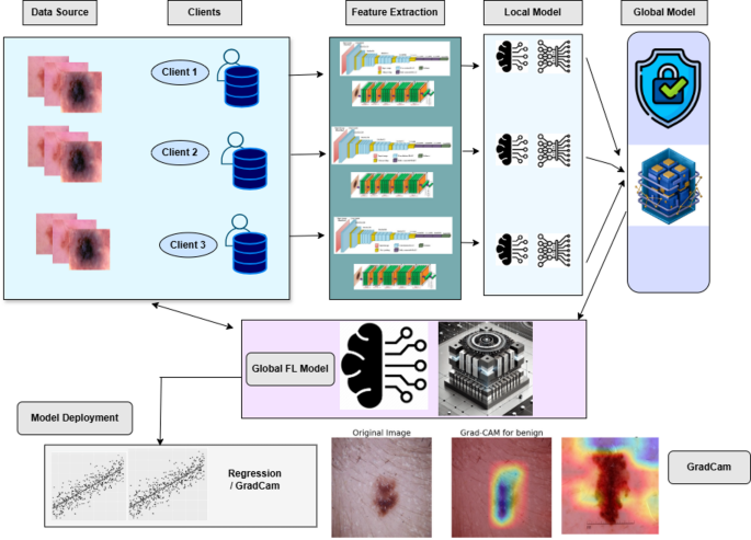 Privacy preserving skin cancer diagnosis through federated deep learning and explainable AI ...