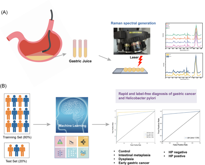 Raman spectroscopy and machine learning for early detection of gastric ...