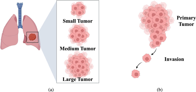 Design of AI-driven microwave imaging for lung tumor monitoring ...