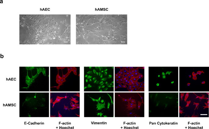 Distinct roles of amniotic membrane epithelial (hAEC) and mesenchymal ...