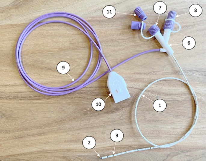 A novel neonatal feeding tube with real time placement guidance ...