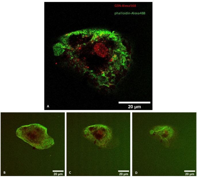 Nuclear and cytoplasmic remodeling of ectocervical cells by high ...